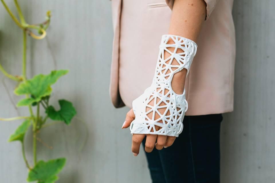 3D printed casts could replace plaster casts﻿ - Textile Technology Source